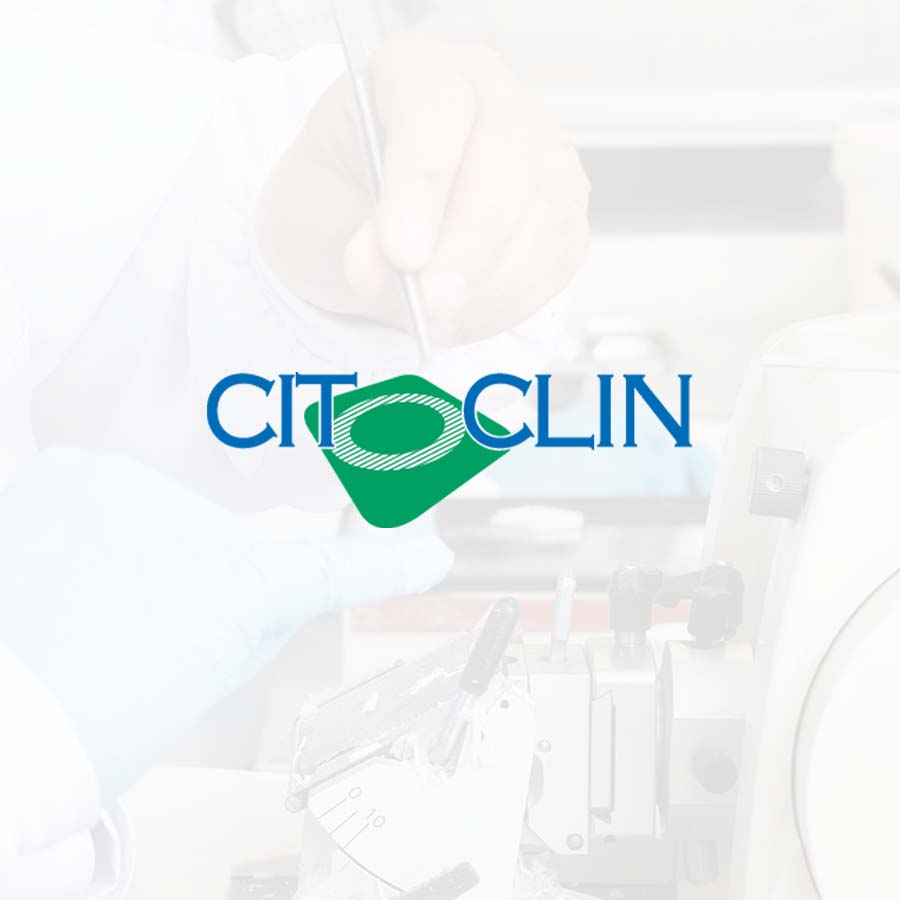 Teste de Schiller: uma ferramenta valiosa na colposcopia